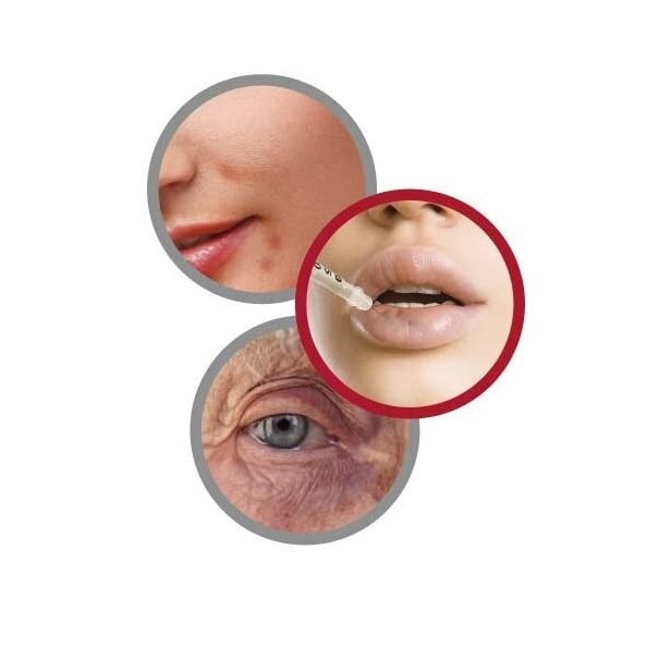 Hematix gel 30g desvanecedor de moretones, hematomas, piel - Sears